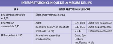 L’escarre talonnière, sa définition & prise en charge